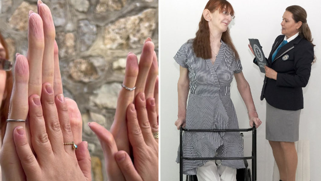 Longest finger on a living person (female) | Guinness World Records