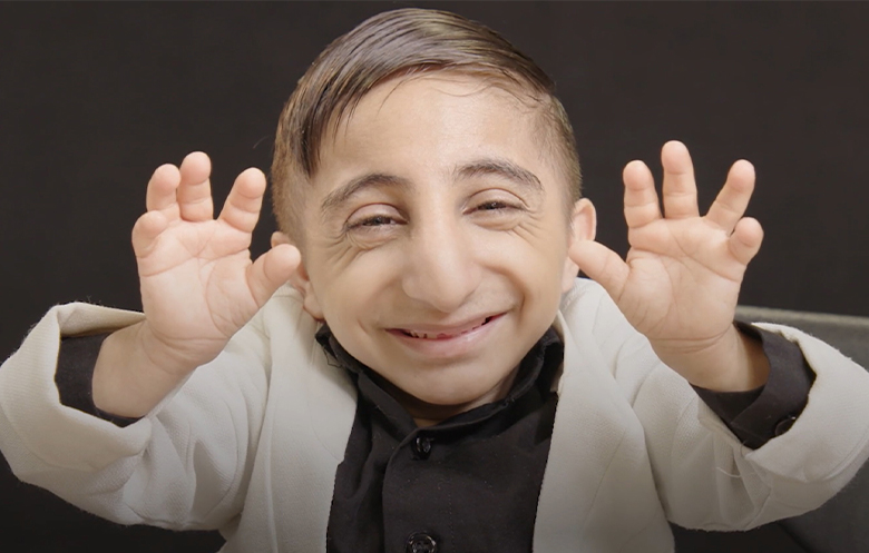 Smallest hands on a living person (male) | Guinness World Records